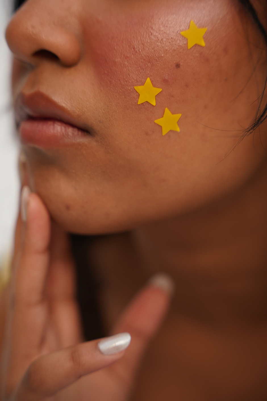 Face Acne Products in Pakistan | Best Acne Solutions 2025 – Poof